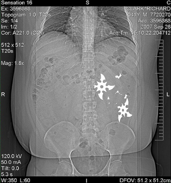 Throwing Star Safety | Throw Ninja Star